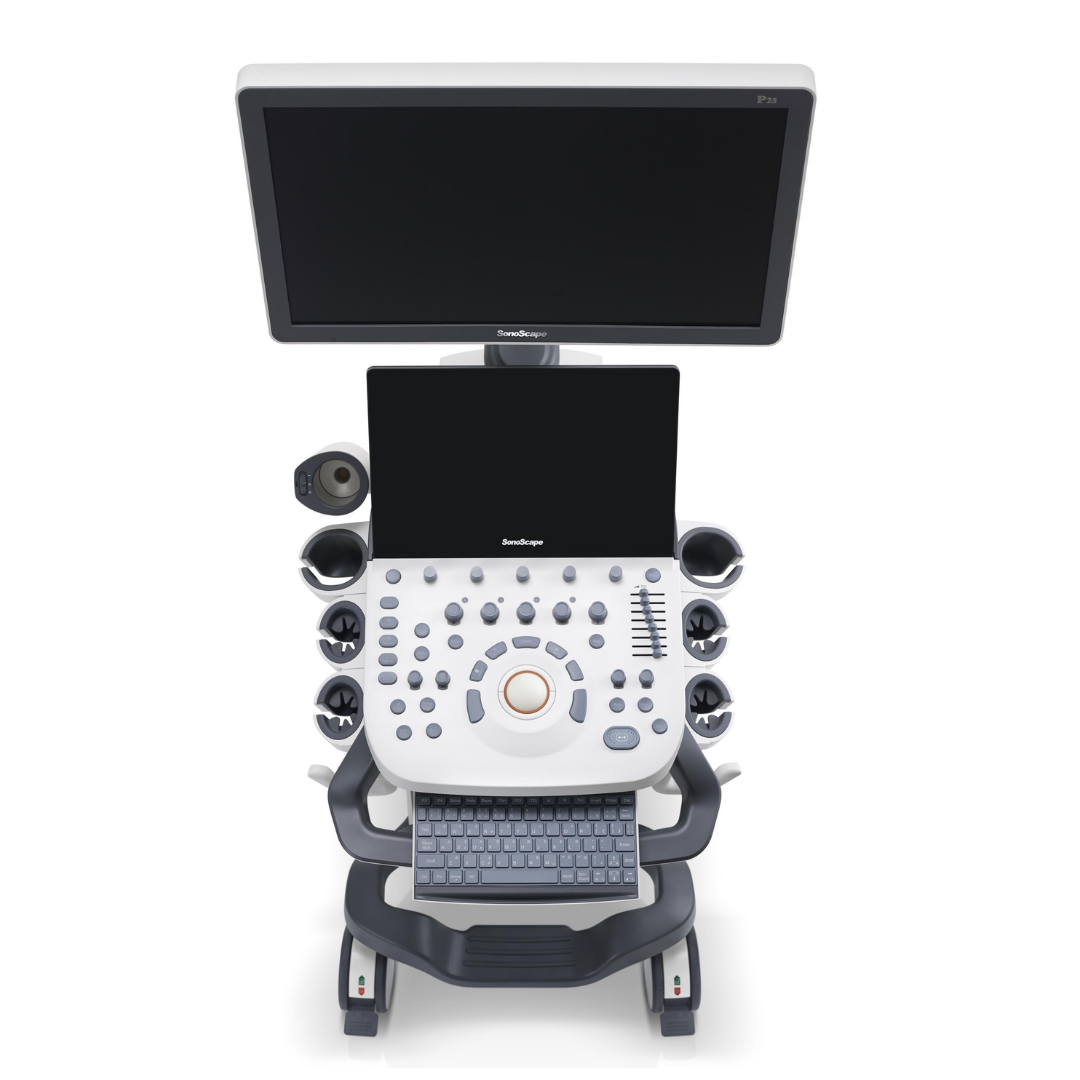 Diagnostic Ultrasound Scanners