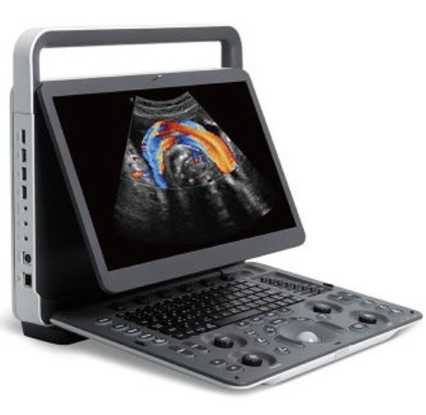 Diagnostic Ultrasound Scanners