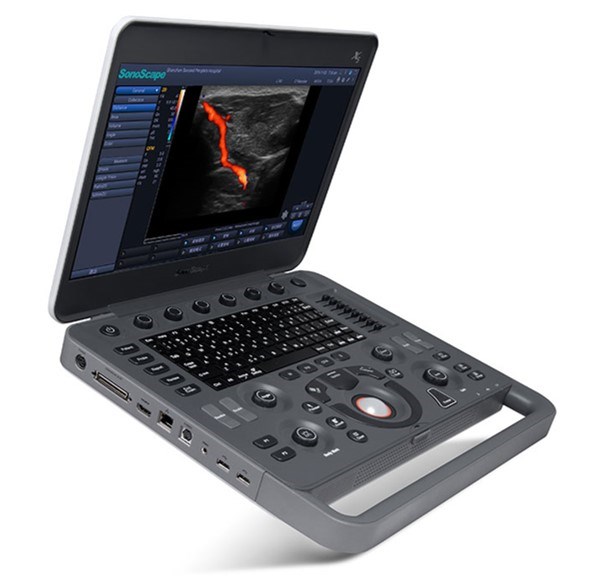 Diagnostic Ultrasound Scanners
