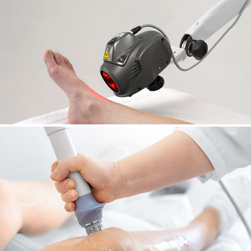 Laser and Shockwave - A Combined Approach? | Celtic SMR